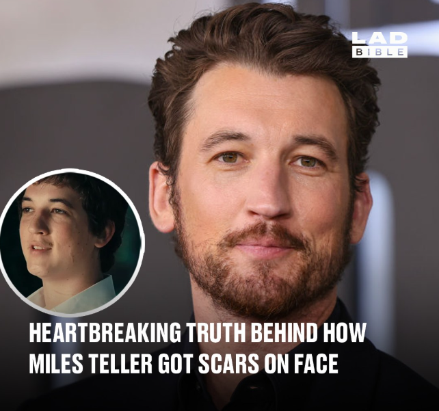 Heartbreaking truth behind how Miles Teller got scars on face - ClassicNews.info