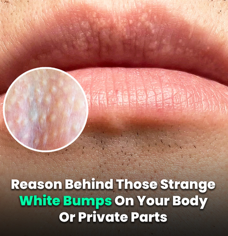 Reason Behind Those Strange White Bumps On Your Body Or Private Parts ...